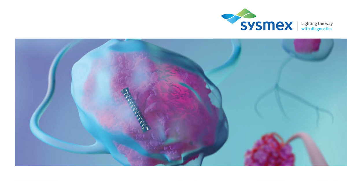 Sysmex goes pink – Let’s fight breast cancer together - Hospital ...
