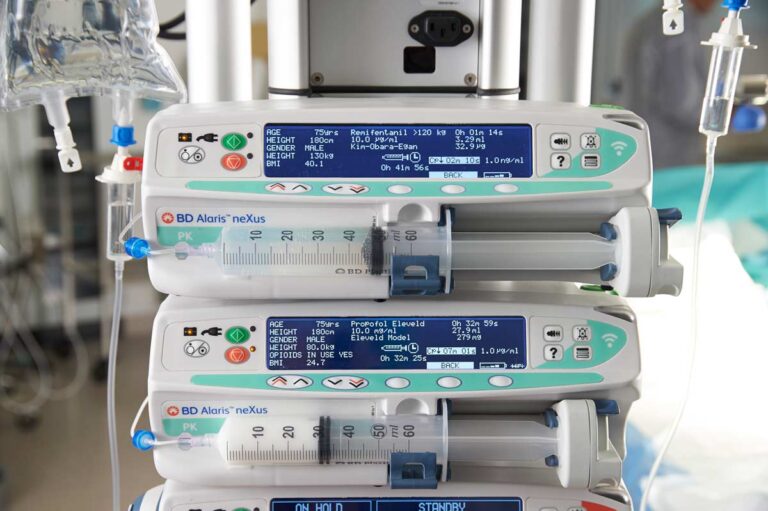 TCI Anesthesia: New and More Universal Models - Hospital Magazine ...