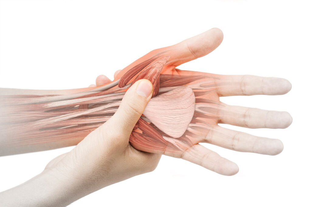 Tendon injuries and treatments - Hospital Magazine - Leading Healthcare ...