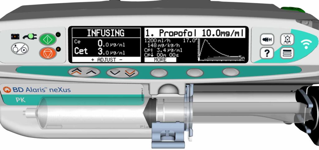 Target Controlled Anaesthesia: Where It’s Going and Why. - Hospital ...