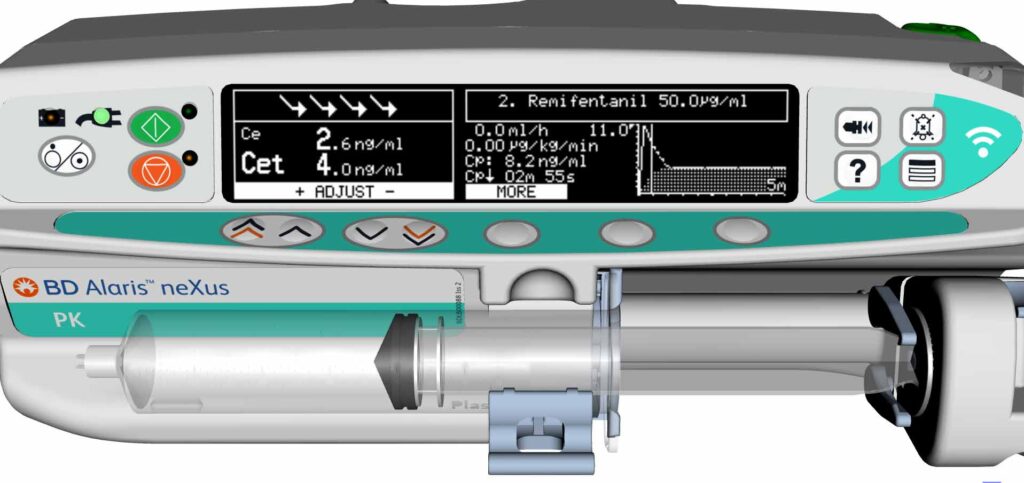 Target Controlled Anaesthesia: Where It’s Going and Why. - Hospital ...