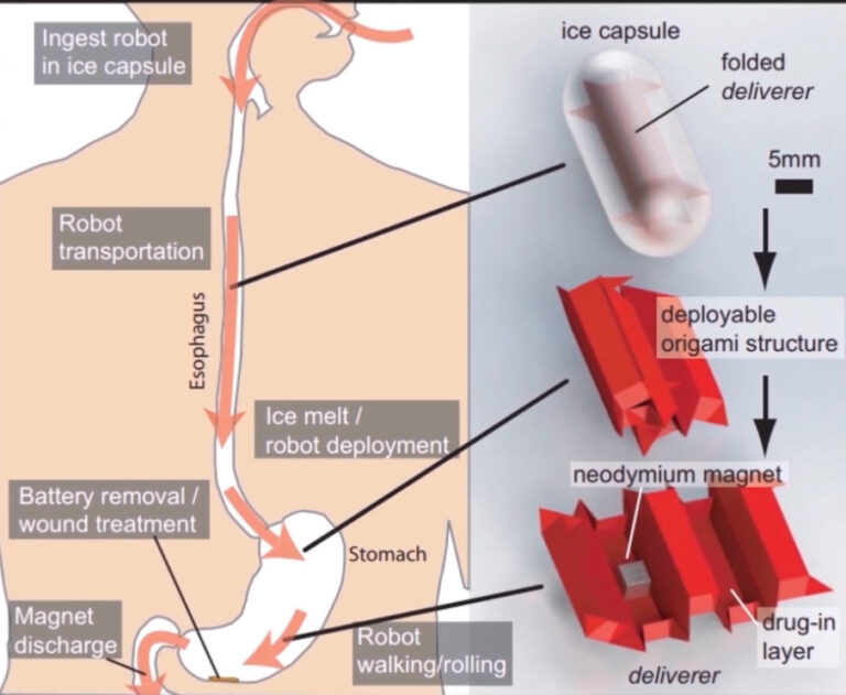 "The Future of Medicine: Ingestible Robots - Revolutionizing ...