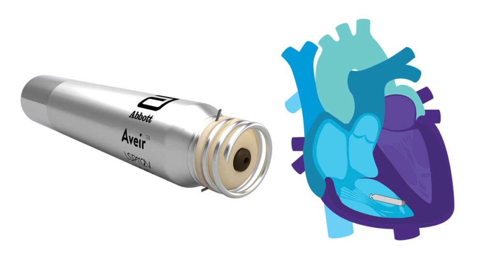 Successful Implant of AVEIR™ Leadless Pacemaker in Morocco - Hospital ...